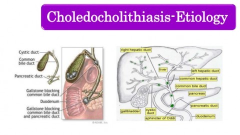 Choledocholithiasis – Life With No Gallbladder – Self Help and Support ...